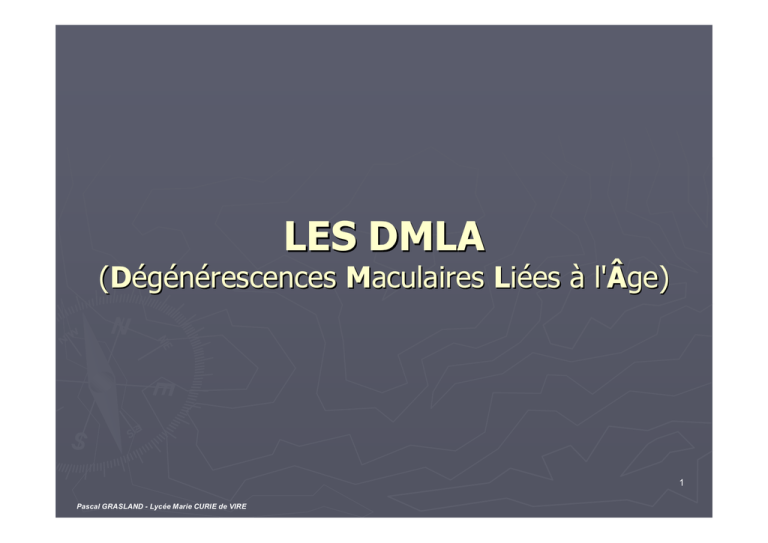 LES DMLA LES DMLA