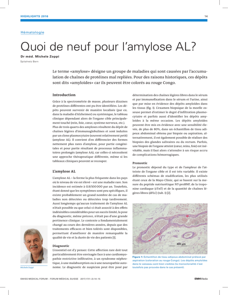Quoi De Neuf Pour L amylose AL 