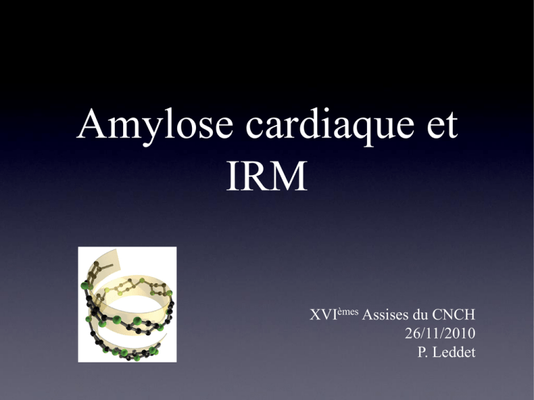 Amylose Cardiaque Et IRM
