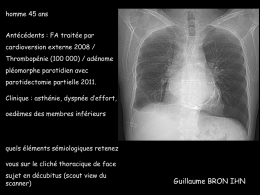 Le péricarde - carabinsnicois.fr