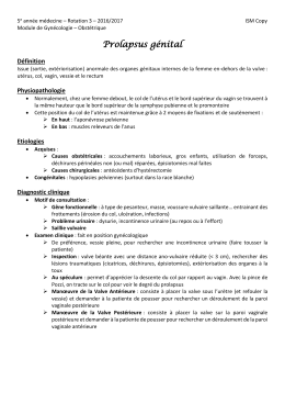 Classification de Baden et Walker du prolapsus
